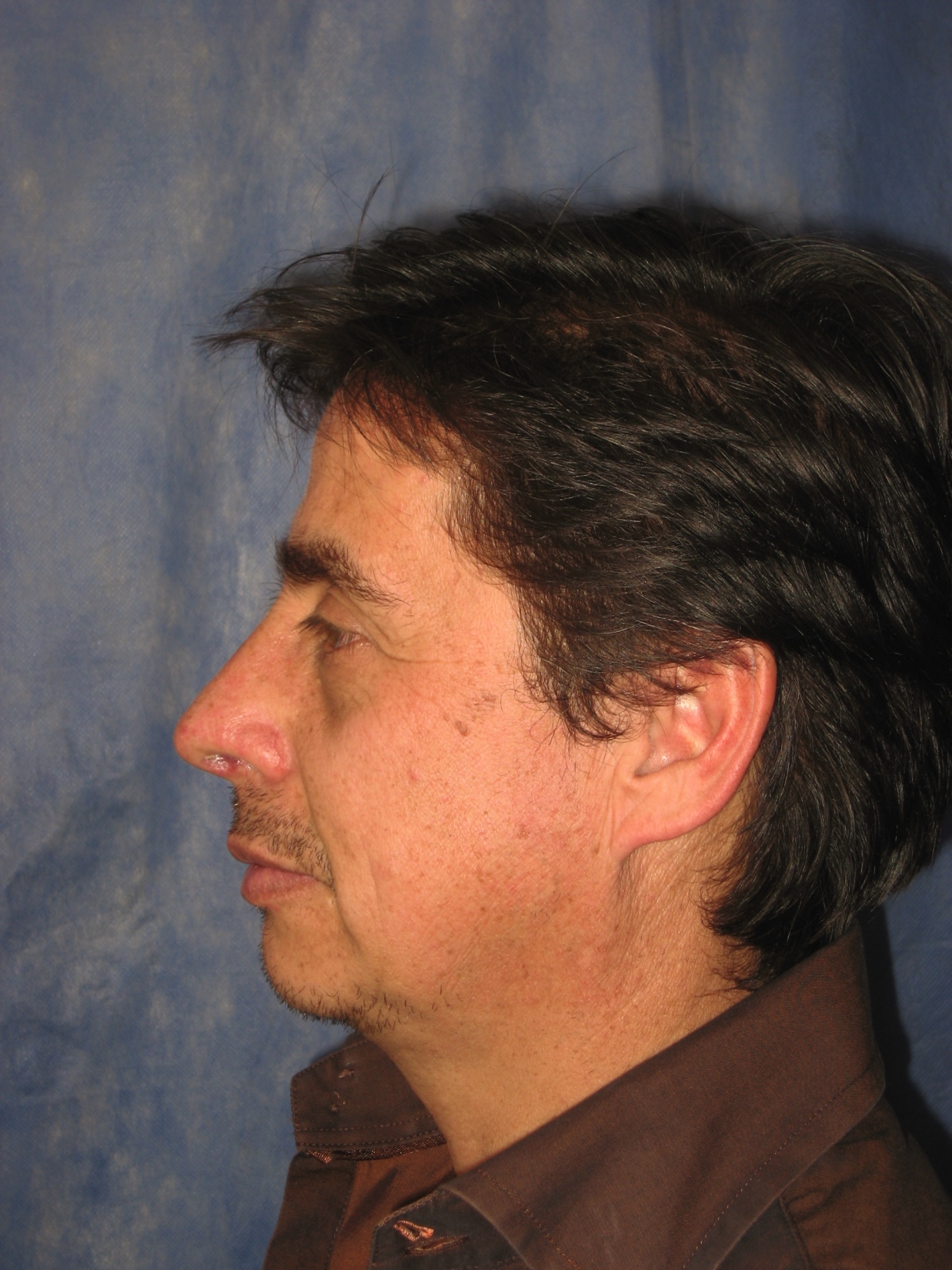 Galeria – Dr Alejandro Lastra